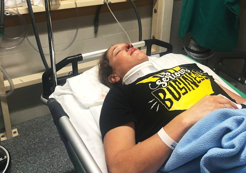 Noga Korem Injured at Training Camp After Hitting Metal Bar - Pinkbike