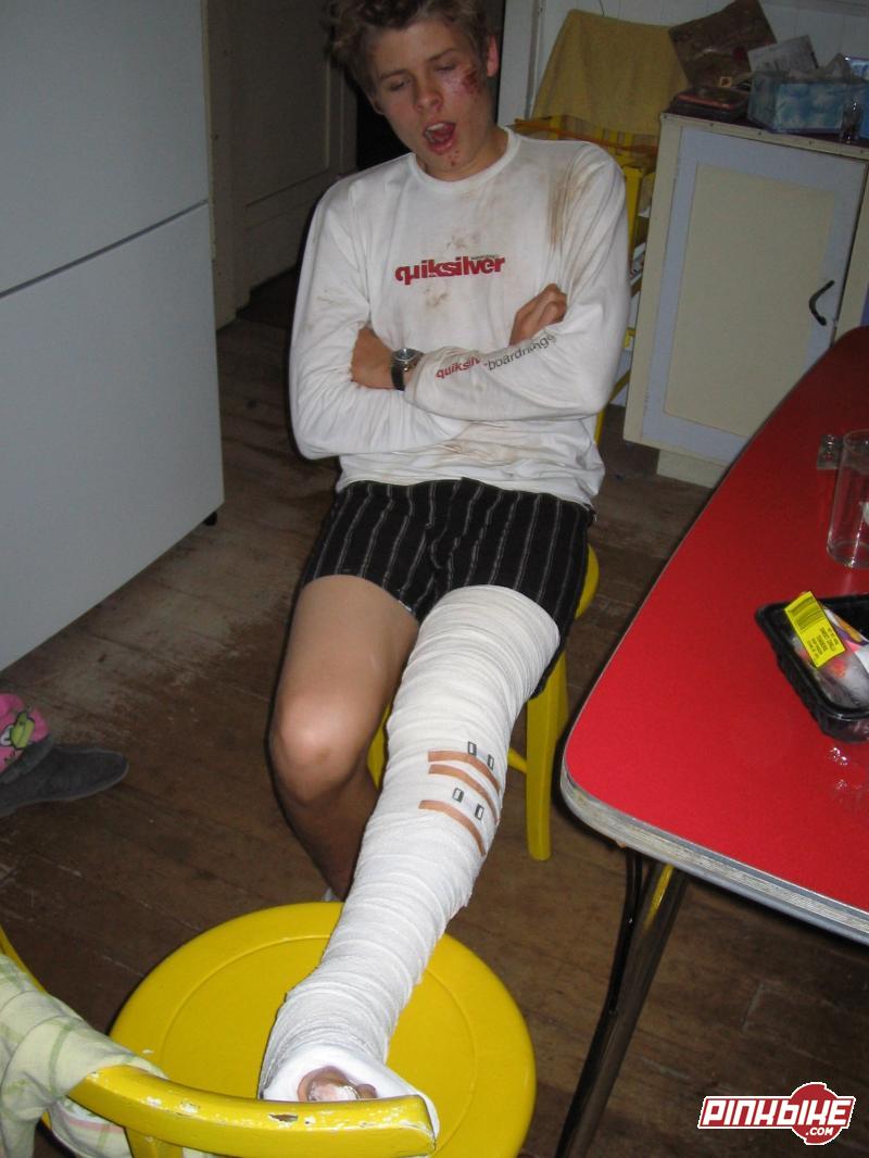 Lachlan the jib cunningham at Mt Cootha in Brisbane, Australia - photo by droofty - Pinkbike