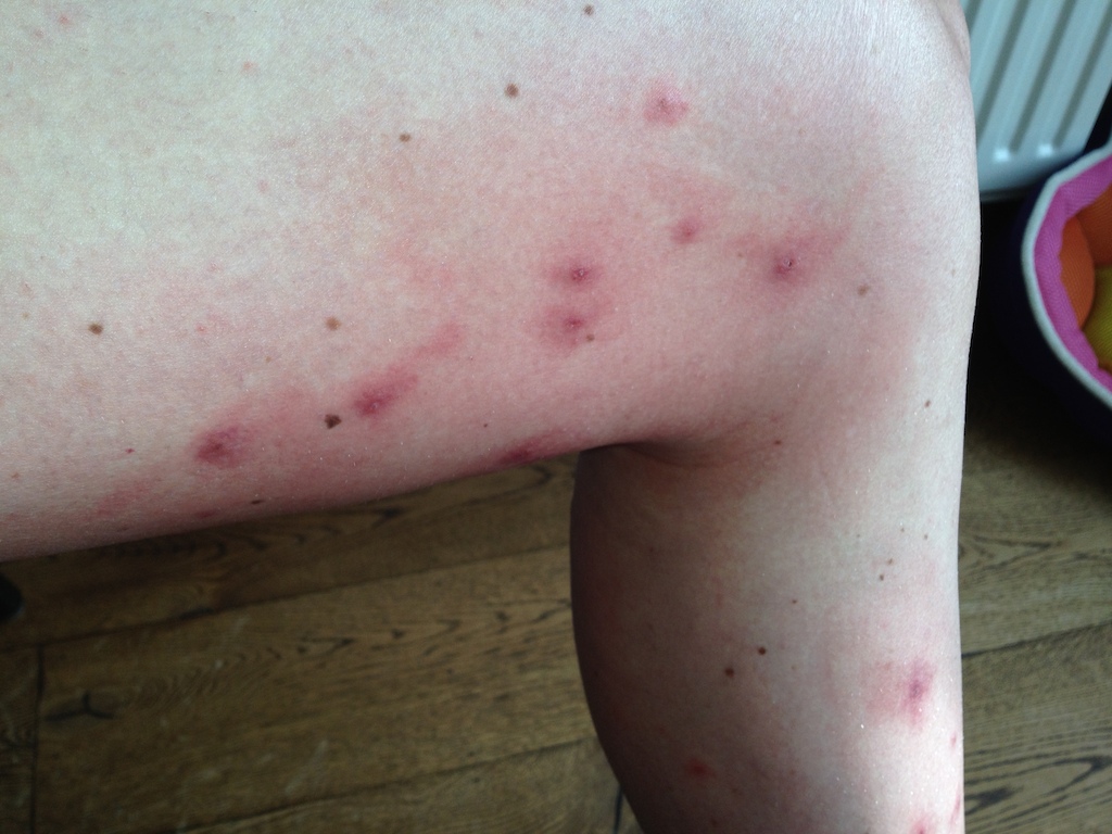 in Schagen, Netherlands - photo by NicoSchagen - Pinkbike